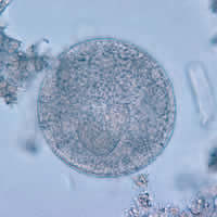 Balantidium Coli Under Microscope