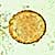 Baylisascariasis - Image Library Thumbnails