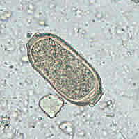 Capillariasis - Microscopy Findings