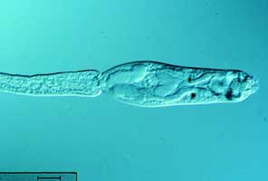 Cercarial dermatitis - Microscopy Findings