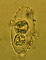 Isosporiasis - Microscopy Findings