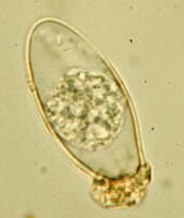 Isosporiasis - Image Library 1