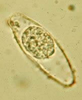 Isosporiasis - Microscopy Findings