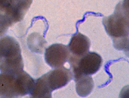 Trypanosomiasis, African - Microscopy Findings