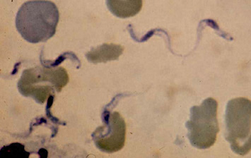 Trypanosomiasis, African - Microscopy Findings
