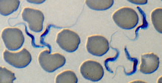 Trypanosomiasis, African - Microscopy Findings